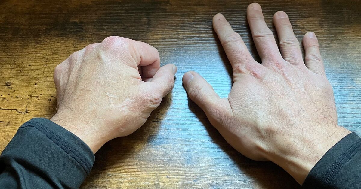 Sharing My Experience with Disability | Rocky Mountain ADA